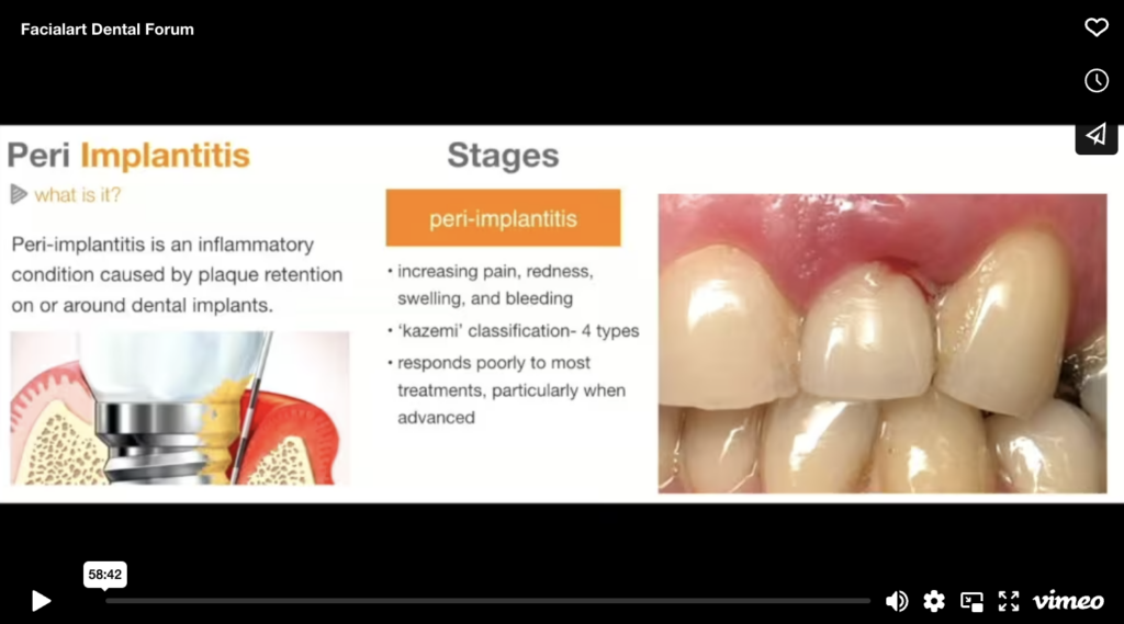 Online Course: Transitional Restorative Options For Optimal Soft Tissue ...
